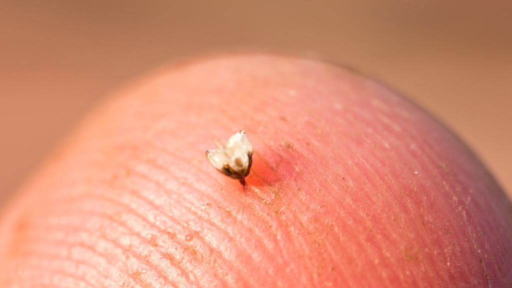 Co Cię gryzie – kompletny przewodnik po ukąszeniach i użądleniach ...